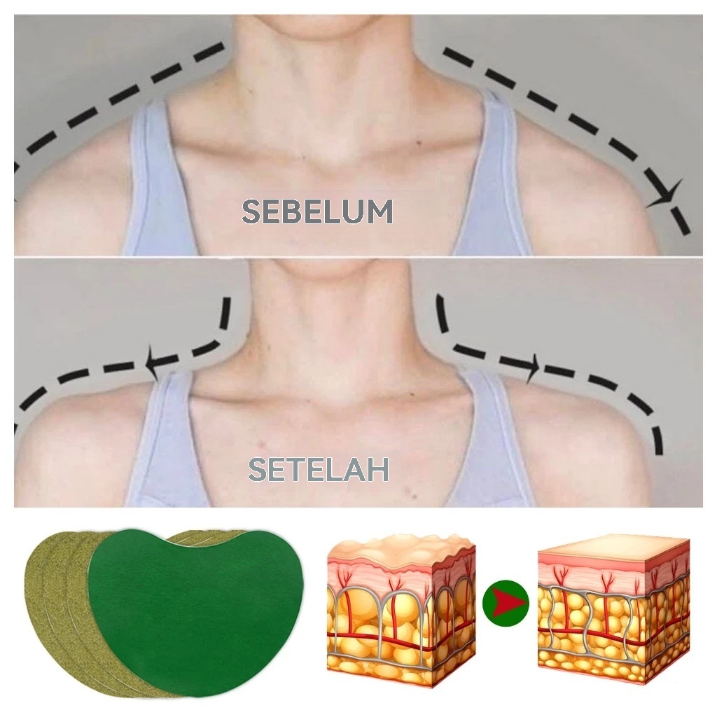 Jual Patch nyeri tulang belakang, patch kekakuan leher, cepat meredakan ...