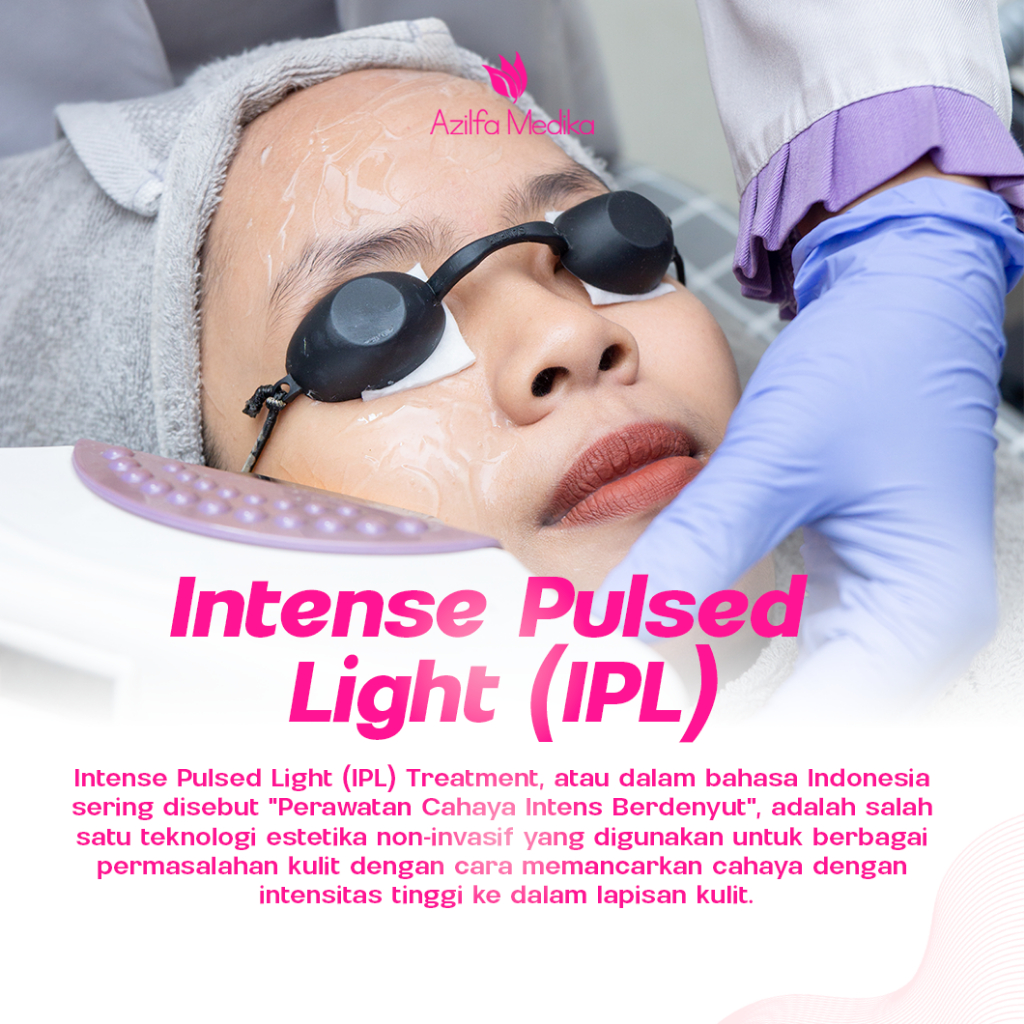 Jual Treatment IPL (Intense Pluse Light) Voucher Treatment Azilfa ...