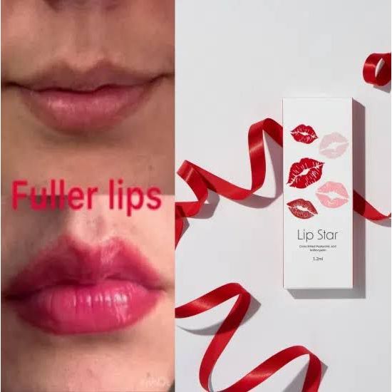 Jual New !! LIP STAR FILLER bibir Treatment for Volume + Natural Colour ...