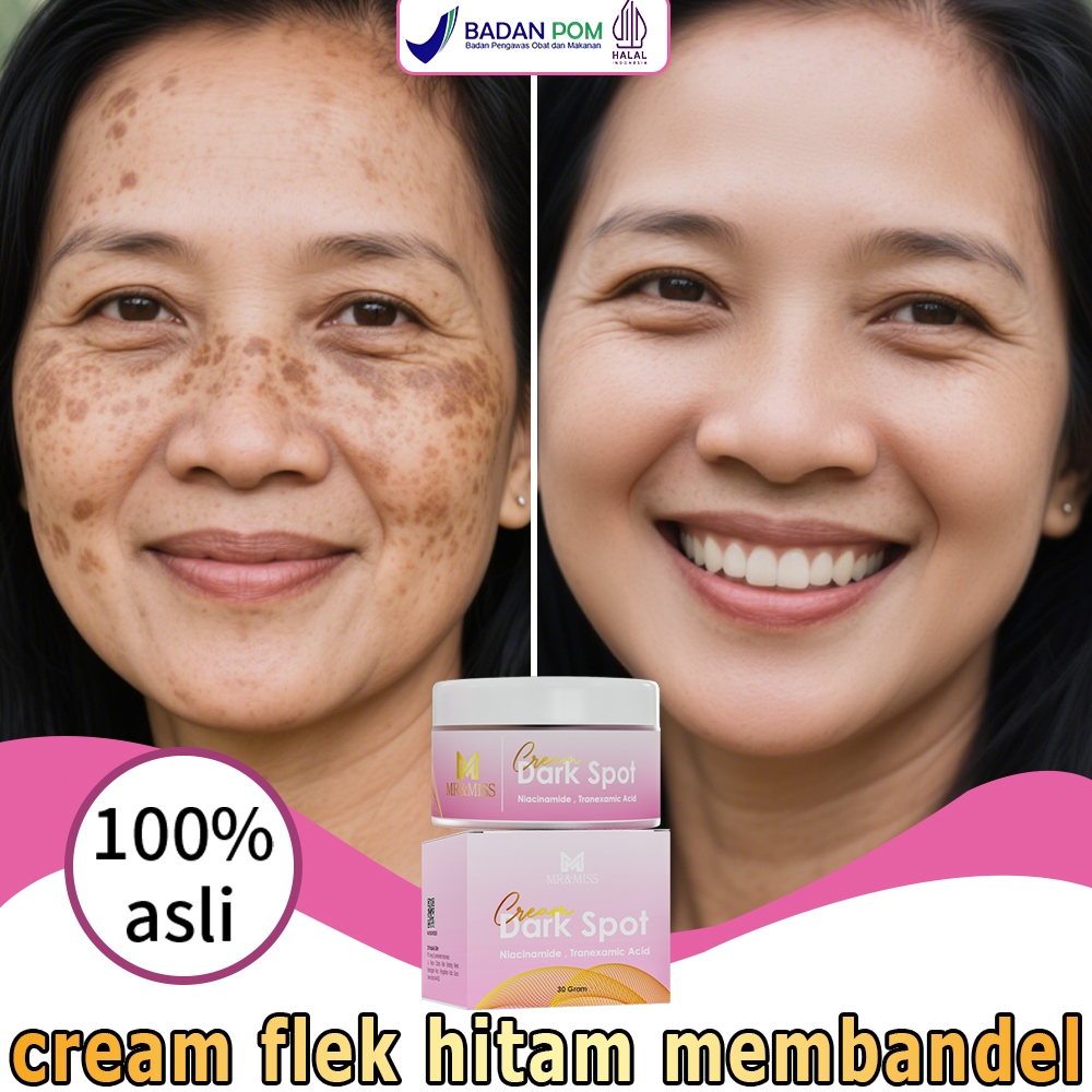 Jual Salep flek hitam membandel menghilangkan flek hitam di wajah krim pemutih wajah bpom 30g ...