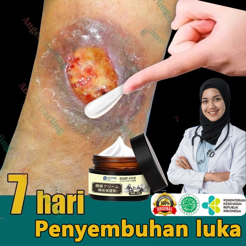 Jual Krim Luka Salep Luka Diabetes Penyembuhan Luka Salep Luka Cepat ...