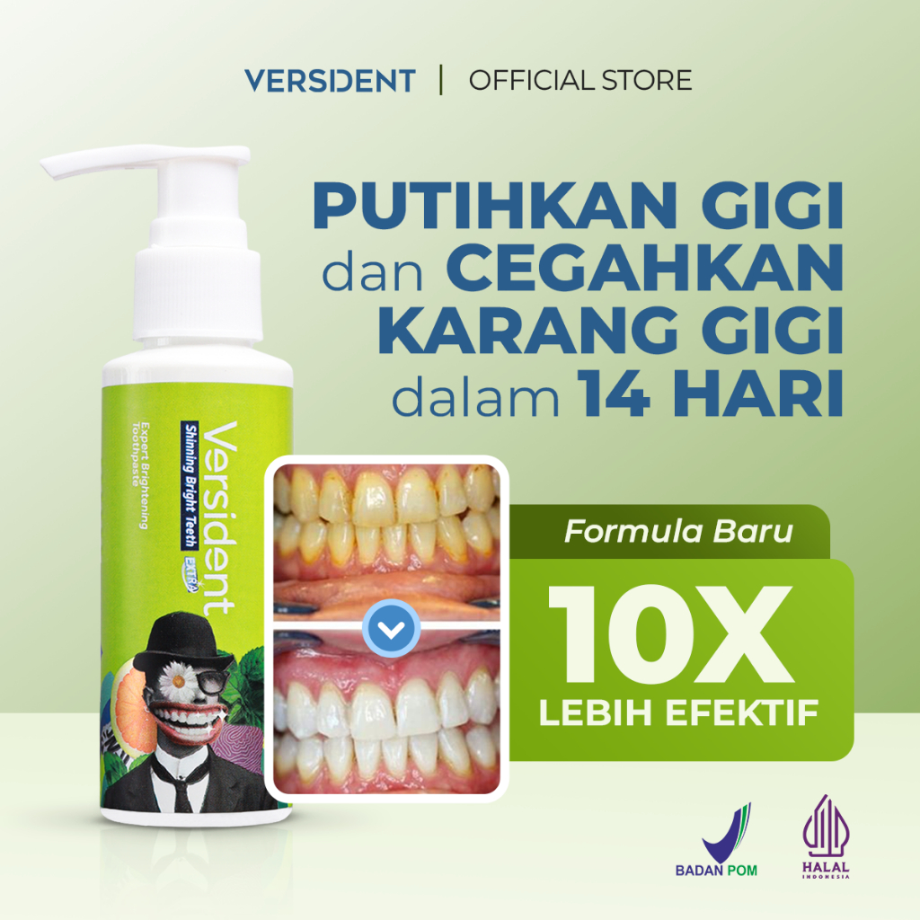 Jual [Ads] Versident Shinning Bright Teeth - Pasta gigi pemutih gigi ...