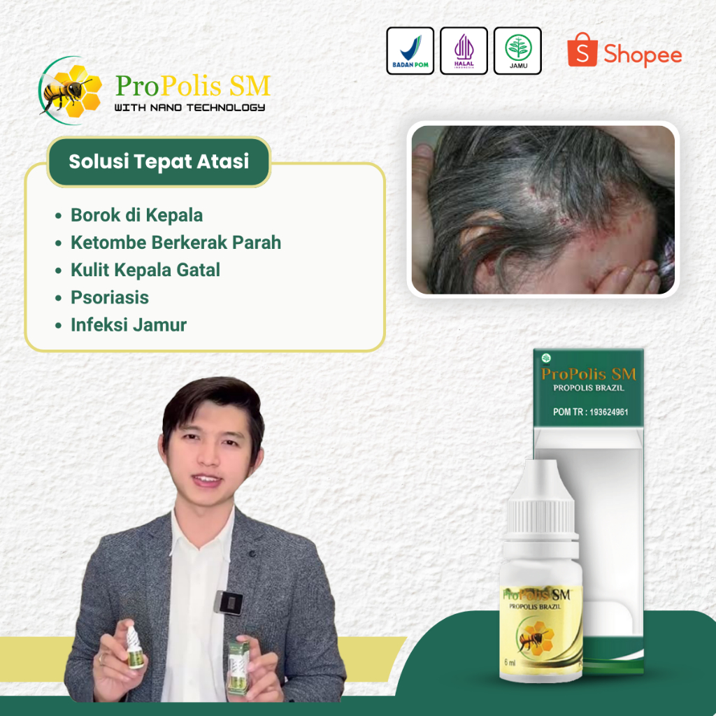 Jual Obat Borok di Kepala, Gatal di Kepala, Ketombe Berkerak Parah, Psoriasis, Infeksi Jamur ...