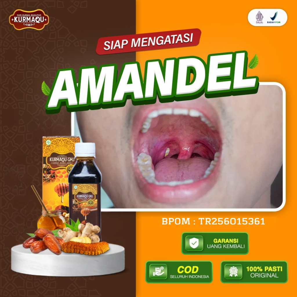 Jual Obat Amandel Radang Amandel Sakit Tenggorokan Radang Pita Suara ...