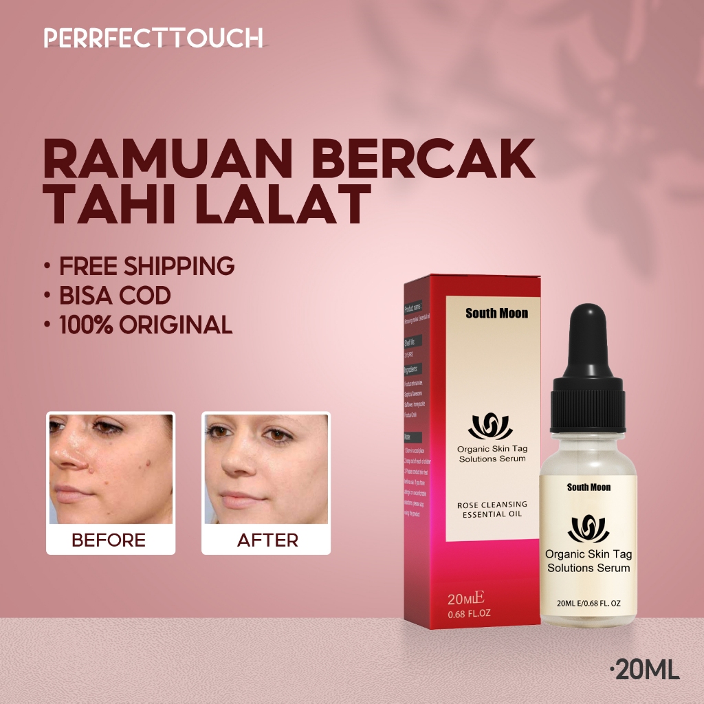Jual South Moon Losion Perbaikan Kulit 20ml Pembersih Kulit Tubuh ...