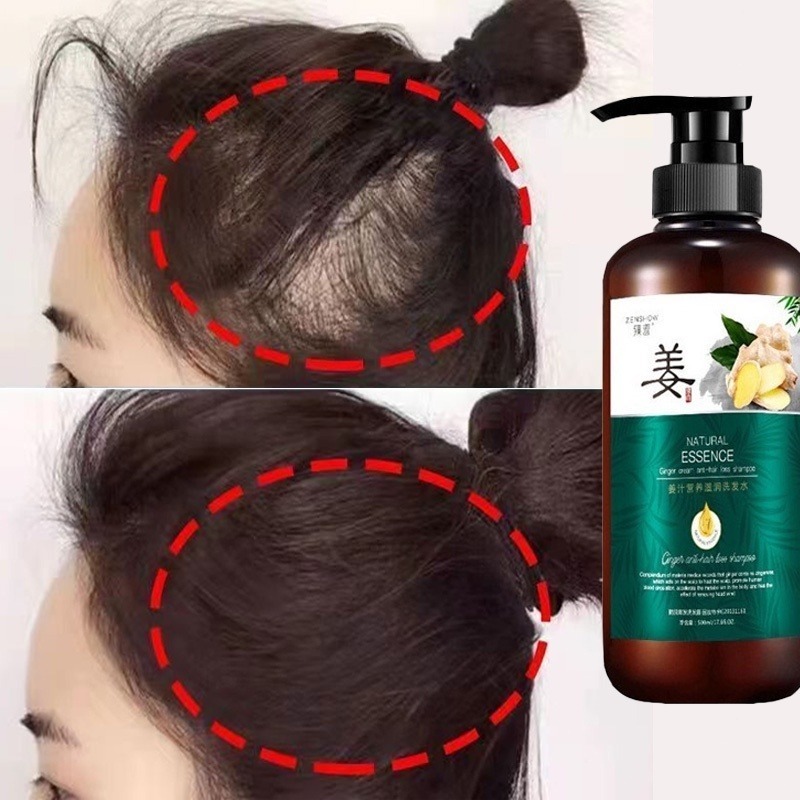 Jual sampo penumbuh rambut cepat perawatan 500ml rambut rontok shampo ...