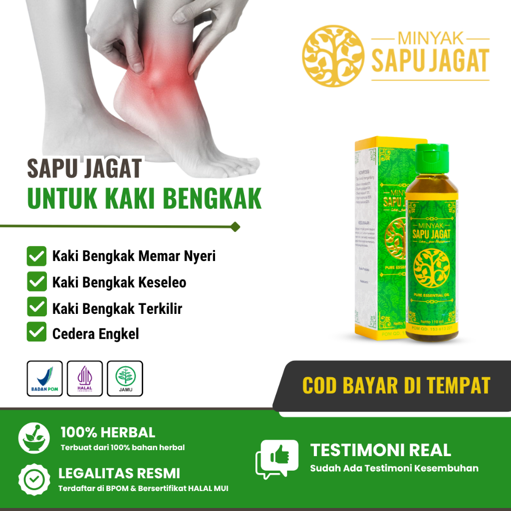 Jual Obat Gosok Kaki Bengkak, Kaki Keseleo Terkilir, Cedera Engkel ...