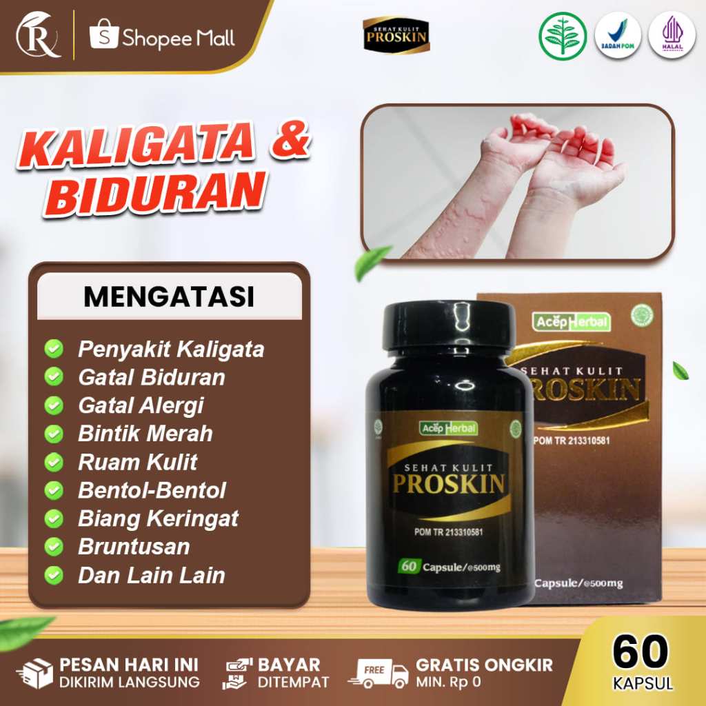 Jual PROSKIN Obat Biduran Kaligata Gatal Alergi Bintik Ruam Merah Biang ...