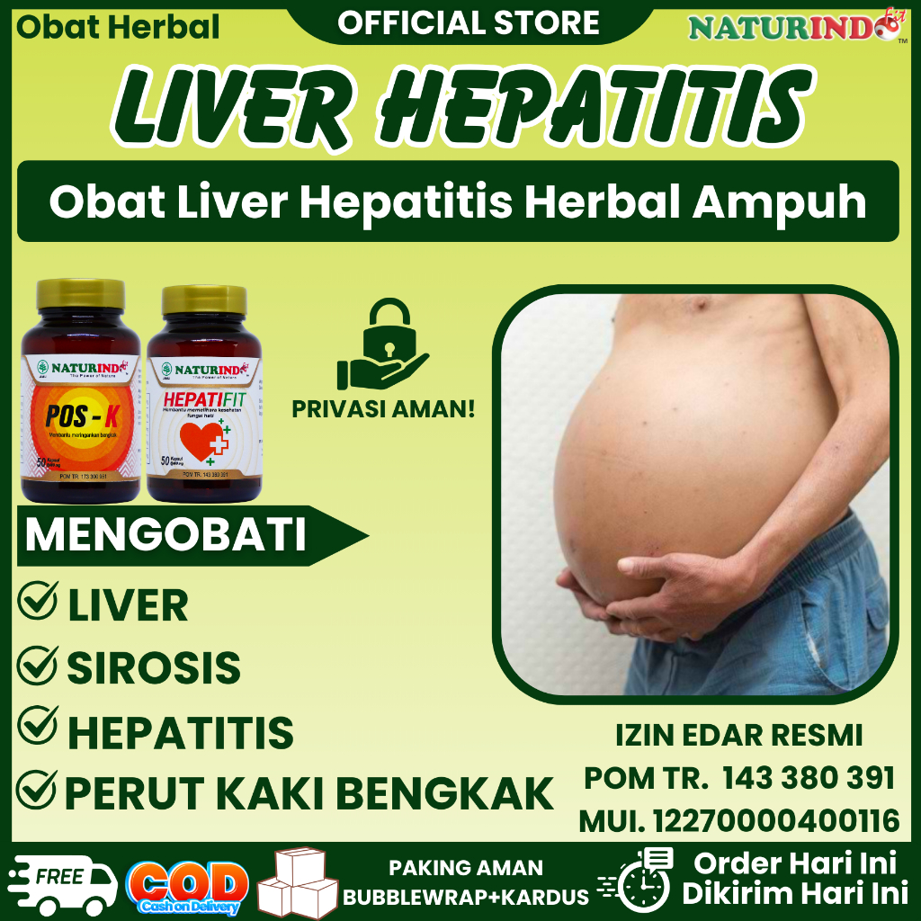 Jual Obat Liver Herbal Hepatitis Sirosis Perut Membesar Kaki Bengkak ...