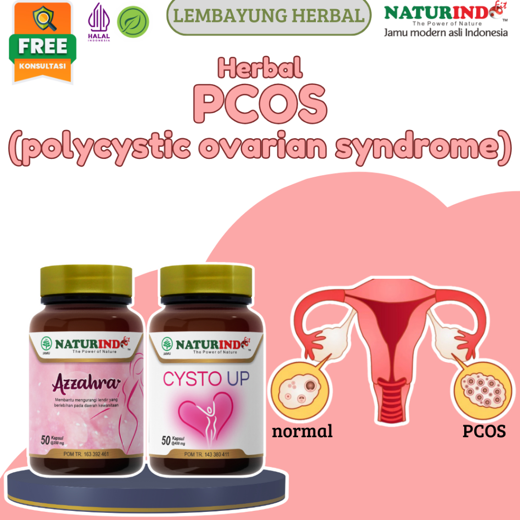 Jual Herbal PCOS Polycystic Ovarian Syndrome Sel Telur Kecil Kecil ...