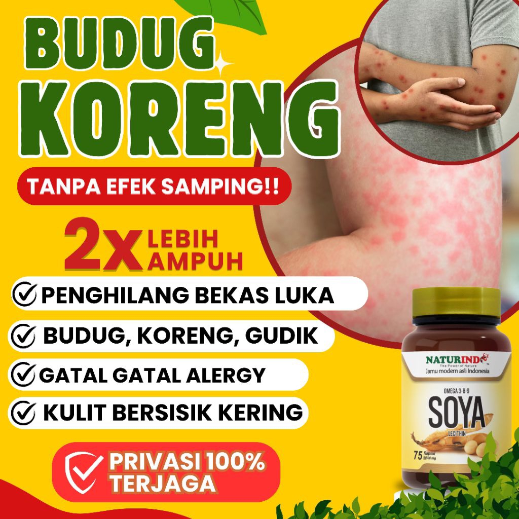 Jual Obat Budug koreng Obat Budug Di Kaki, Obat Budug Santri, Obat ...