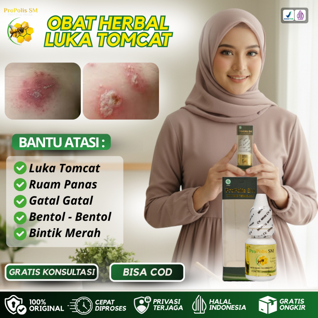 Jual Obat Salep Terkena Tomcat, Obat Oles Luka Tomcat, Obat Gigitan ...