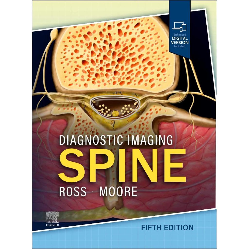 Jual Diagnostic Imaging: Spine, 5th Edition 2025 | Shopee Indonesia