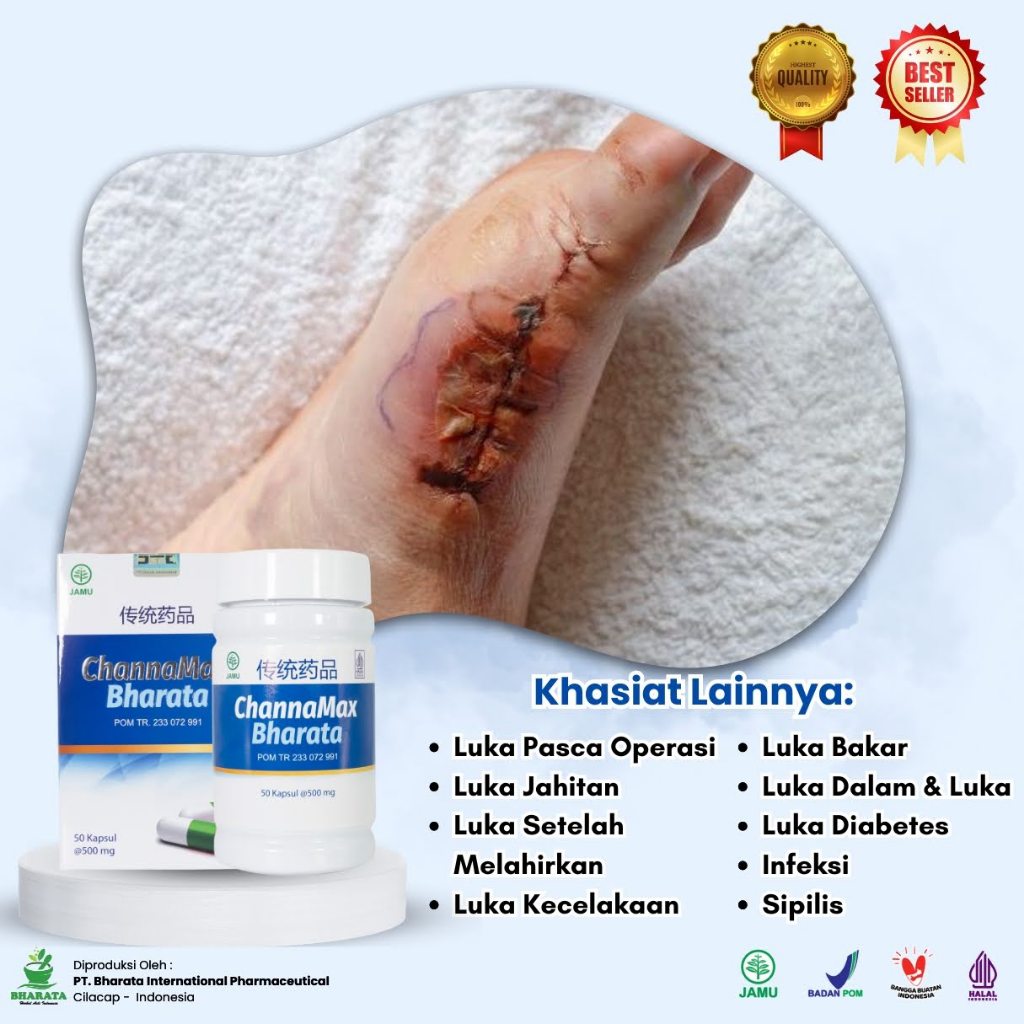 Jual Channamax Bharata Obat Luka Pasca Operasi Caesar Diabetes Bernanah ...