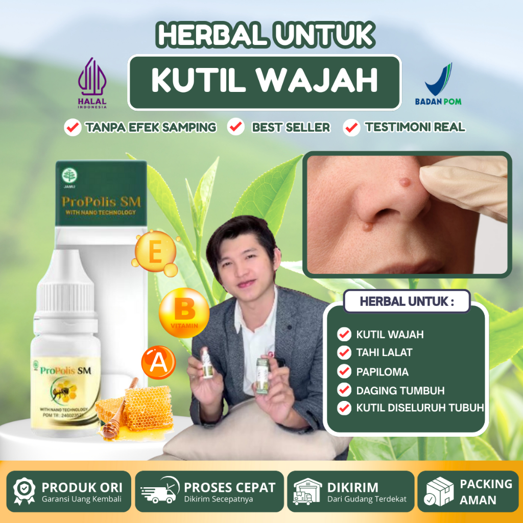 Jual Obat Kutil Wajah, di Kelopak Mata, Penghilang Kutil Papiloma Wajah ...