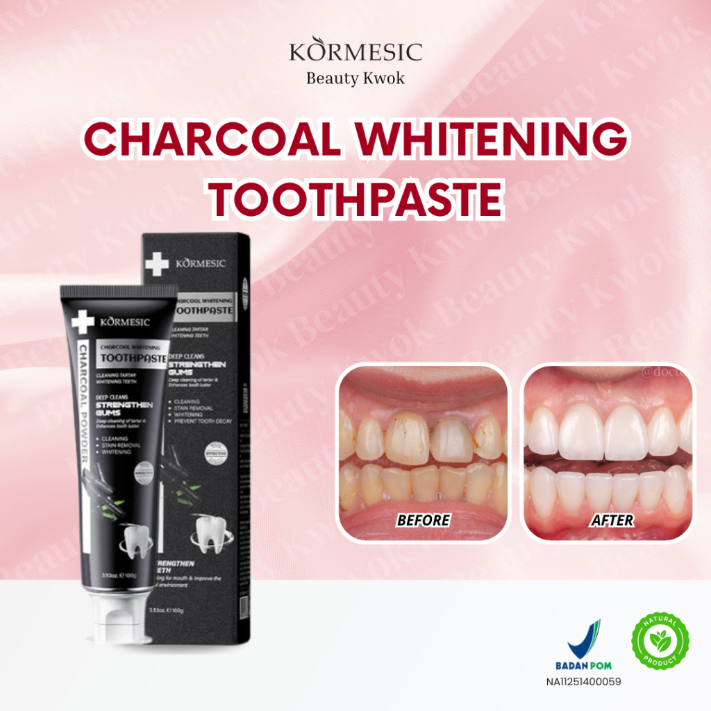Jual [BPOM] KORMESIC Charcoal Whitening Toothpaste 100gr Pasta Gigi ...