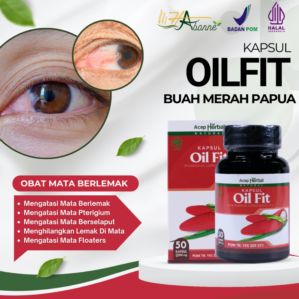 Jual Obat Mata Berlemak, Mata Pterigium, Mata Berselaput, Glukoma ...