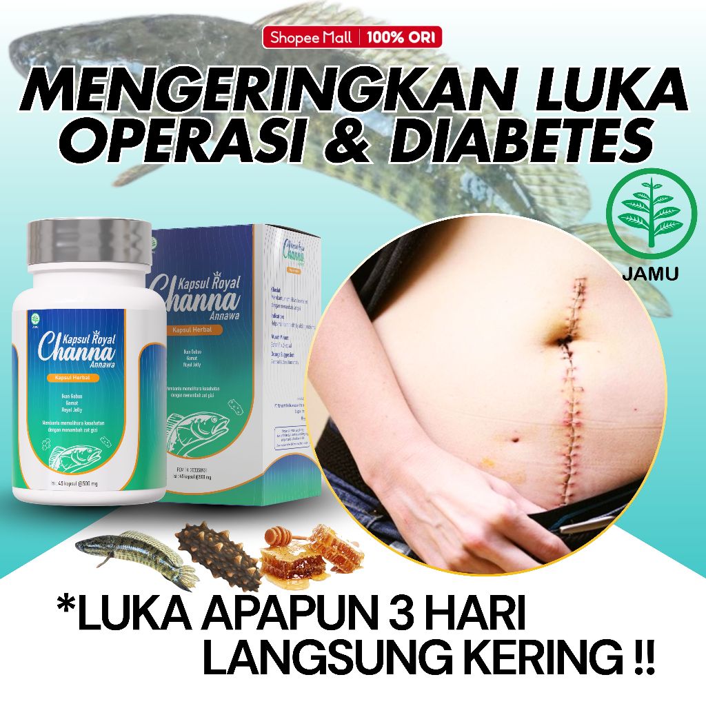 Jual Royal Channa - Kapsul Kutuk Premium - Sembuhkan Luka Sesar, Pasca ...
