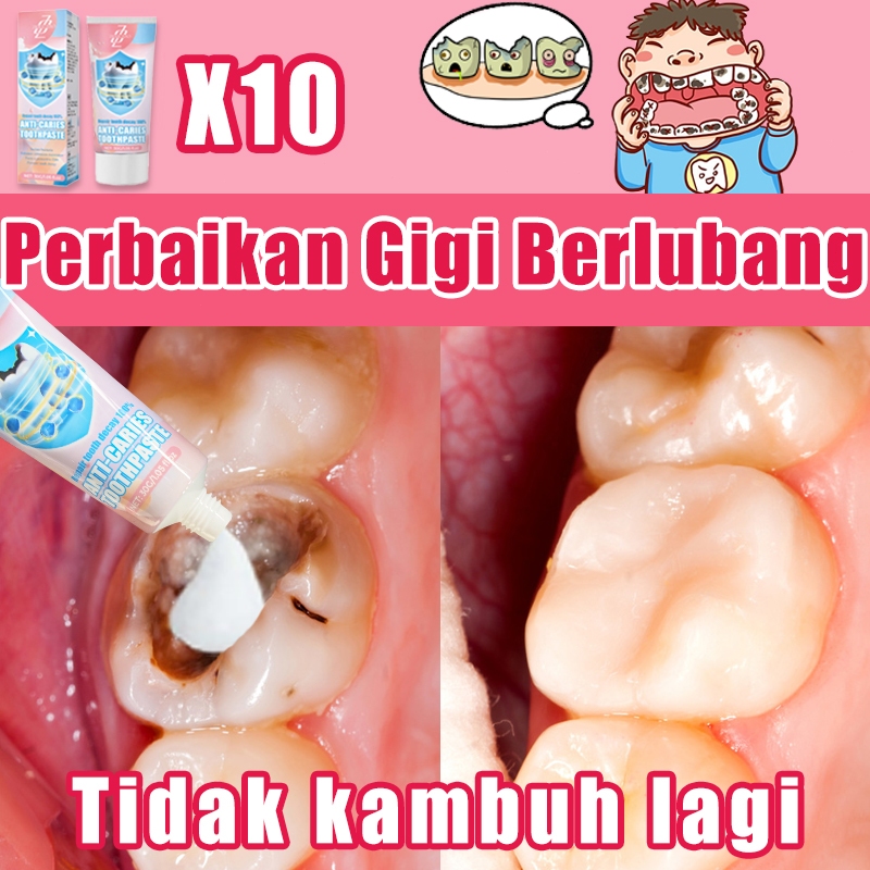 Jual Pasta Gigi Anti Gigi Berlubang Pasta Gigi Anak & Dewasa 2in1 Solusi Gigi Berlubang & Ngilu ...