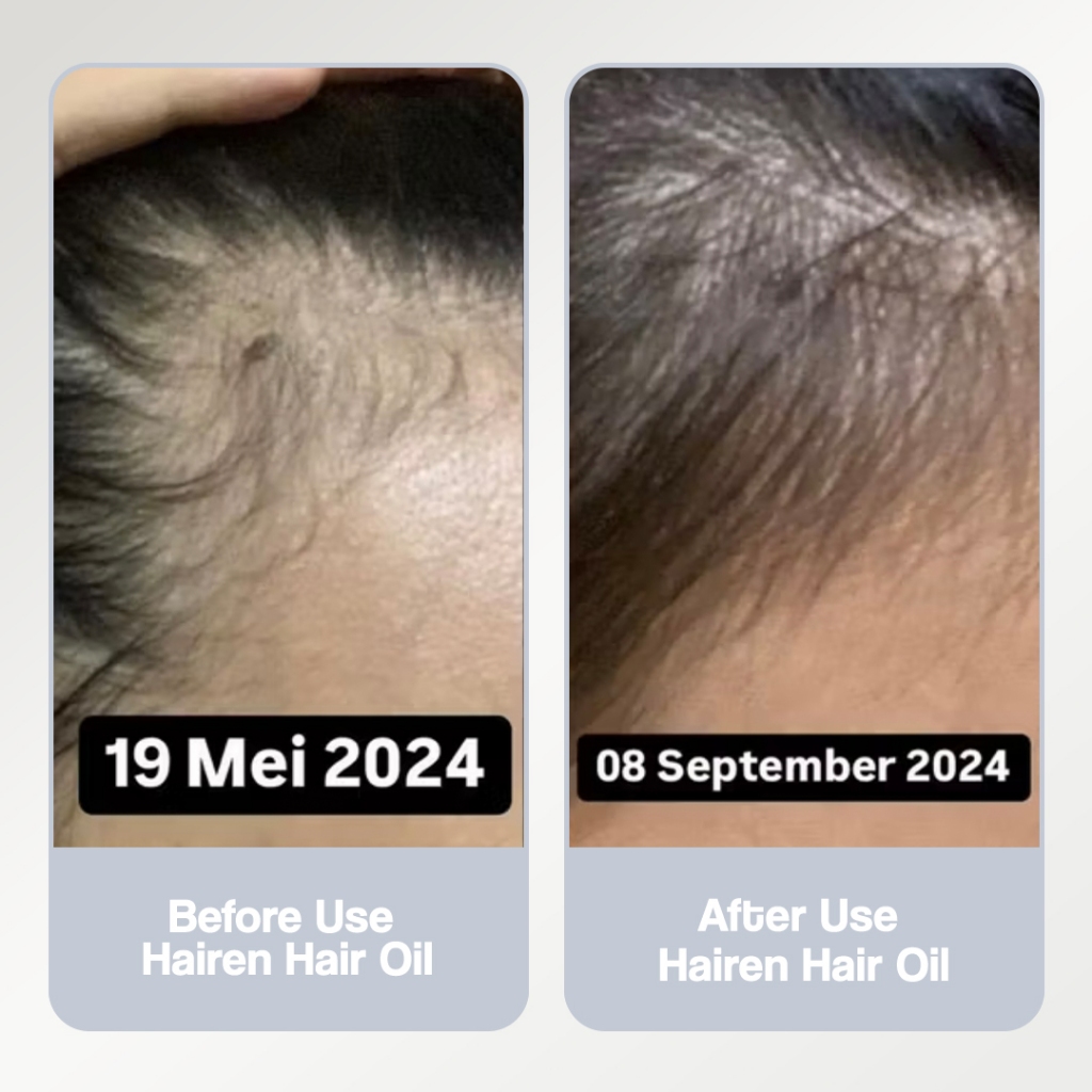 Jual [FREE GIFT] Hairen Hair Oil + Hair Repair Mask BPOM APPROVED ...