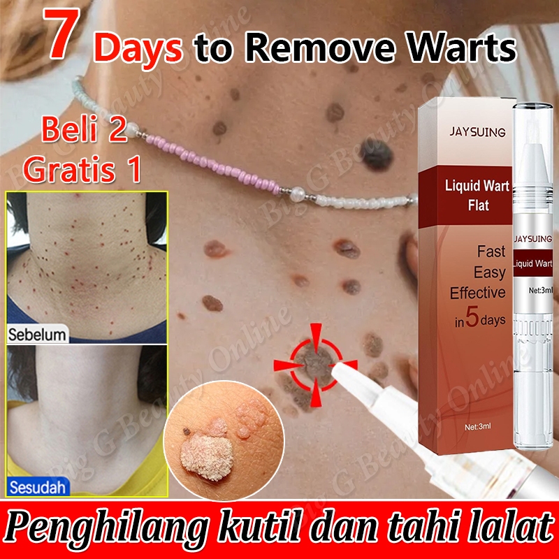 Jual Obat Penghilang Kutil 0bat Kutil Leher Penghilang Kutil Dan Tahi ...