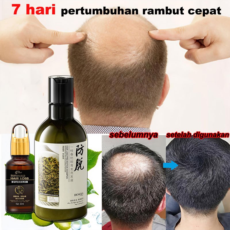 Jual Shampoo Rambut Rontok Ekstrak Herbal Thunifera Anti DHT untuk Pria ...