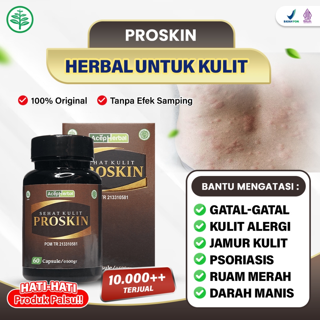 Jual Proskin Obat Gatal Herbal Original Obat Budug, Gatal Gatal ...