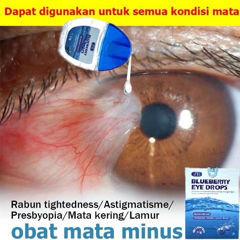 Jual Obat mata katarak Blueberry Eye drop Obat mata merah Pengobatan ...