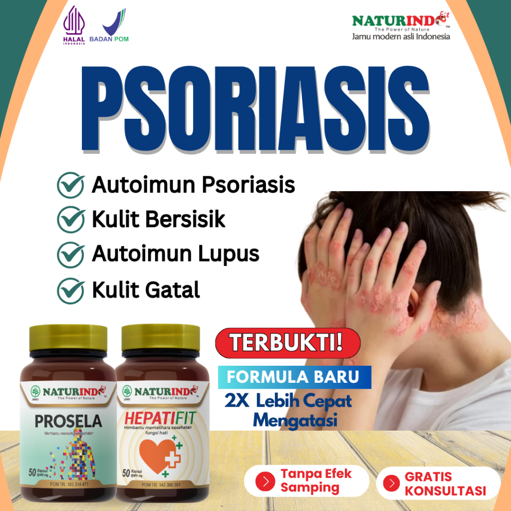 Jual Obat Autoimun Psoriasis Lupus Nyeri Sendi dan Gatal Alergi Ruam ...