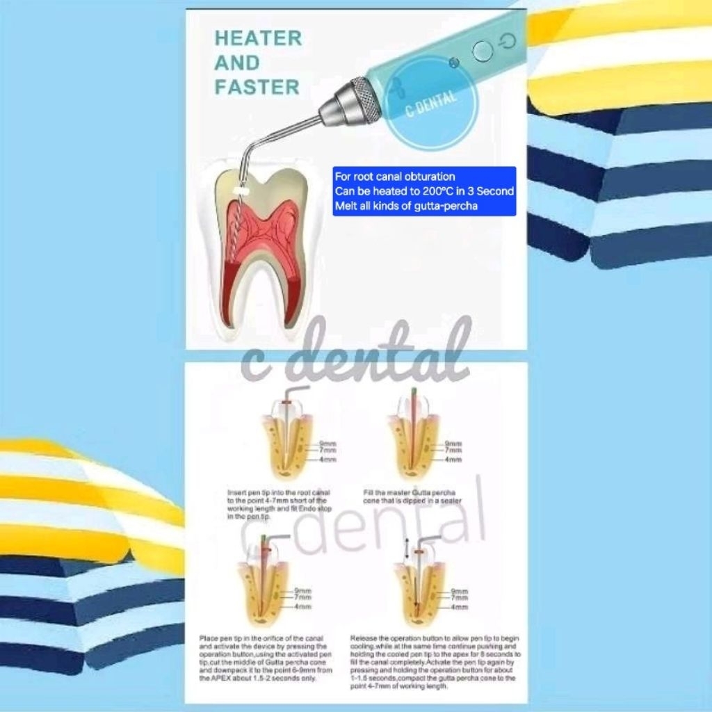 Jual [1 Set] Dental Endo Gutta Percha Heating Pen Plugger Cordless ...