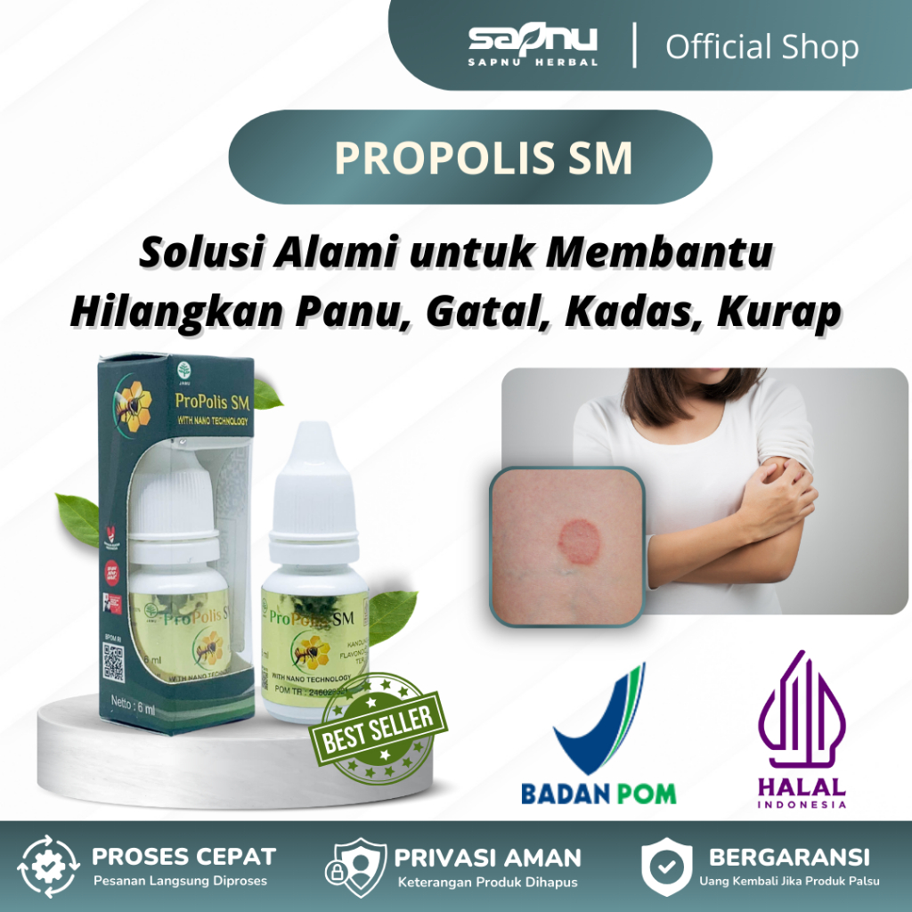 Jual Obat Herbal Panu Alami PROPOLIS SM – Antijamur & Antibakteri Kulit ...