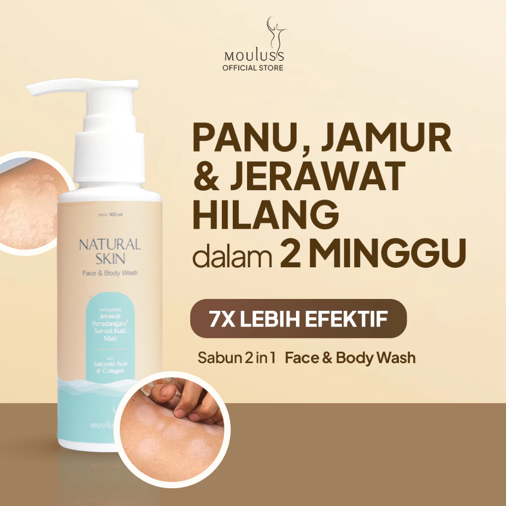 Jual Mouluss - Sabun Panu Penghilang Panu, Atasi Masalah Kulit Jamur ...