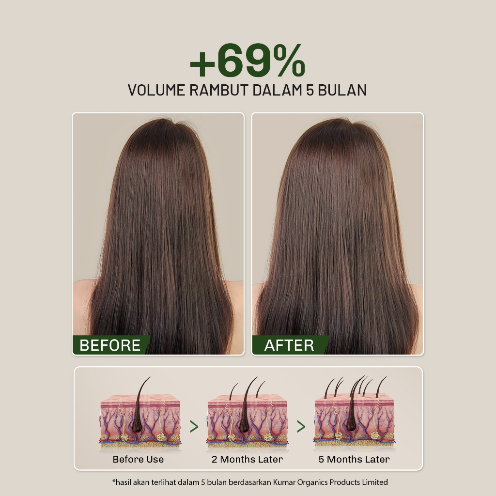 Jual [HAIR CARE BUNDLE] Lavojoy Shampoo + Conditioner | Perawatan ...