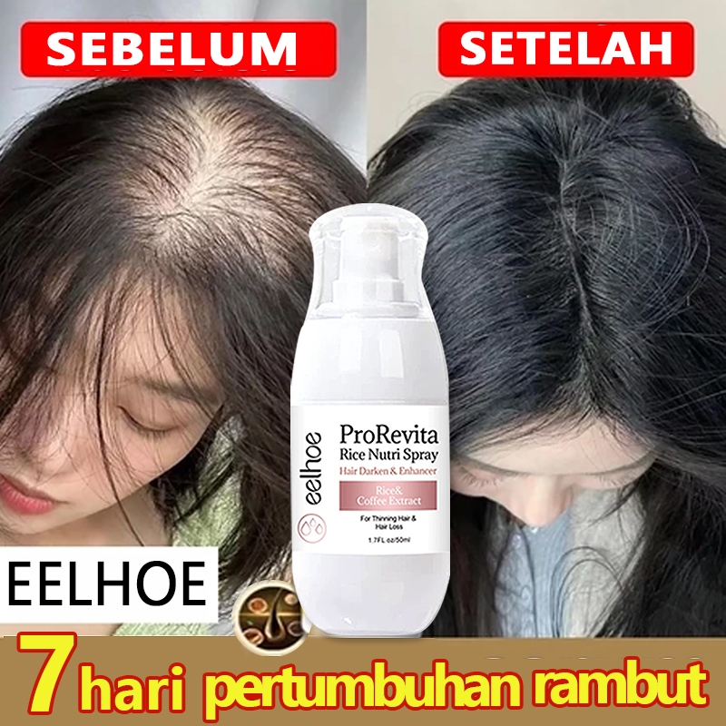 Jual Serum Rambut Rontok Parah Dan Penumbuh Rambut Cepat Penebal Rambut ...