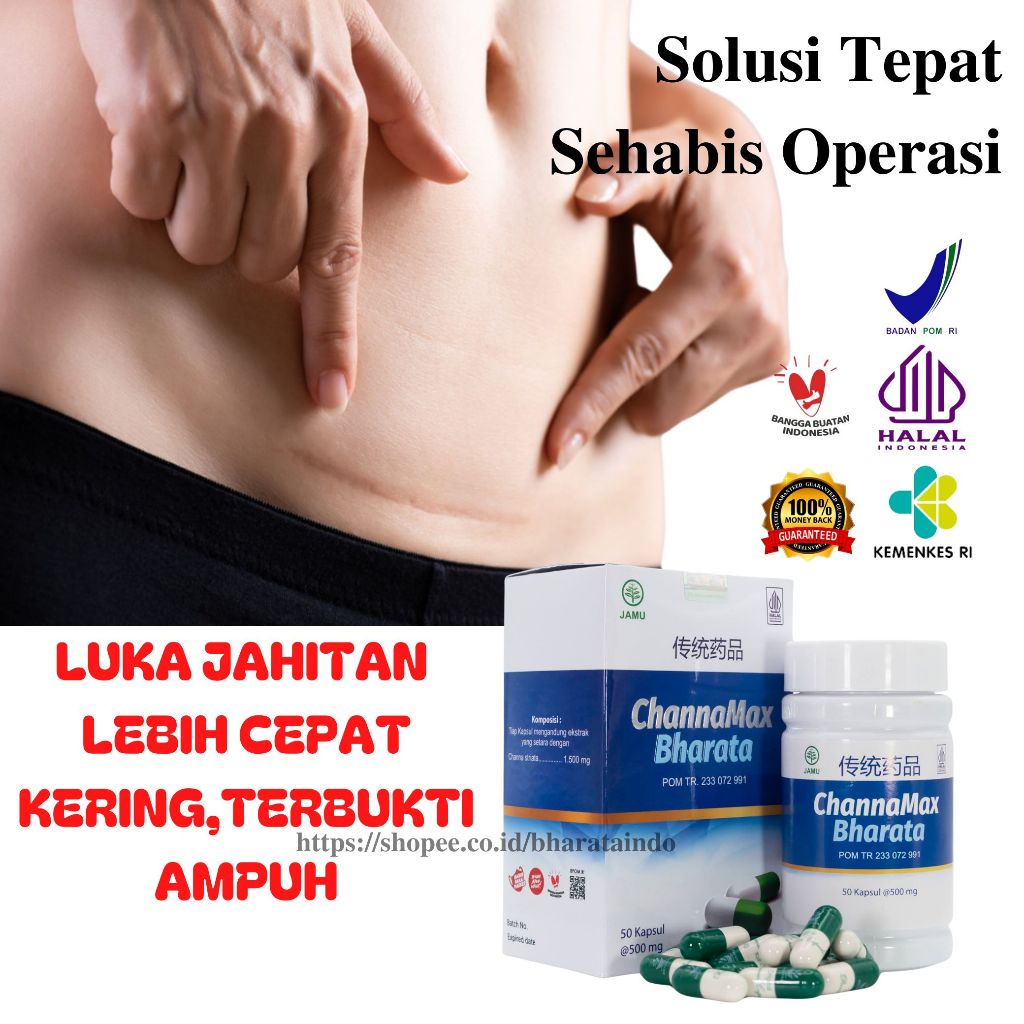 Jual Obat Pengering Luka Operasi Cepat Sembuh Ampuh CHANNAMAX BHARATA ...