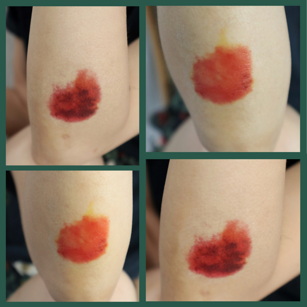 Jual [PRODUK LOKAL] BUNDLING TATO TEMPORER FRESH BRUISE & HEALING ...