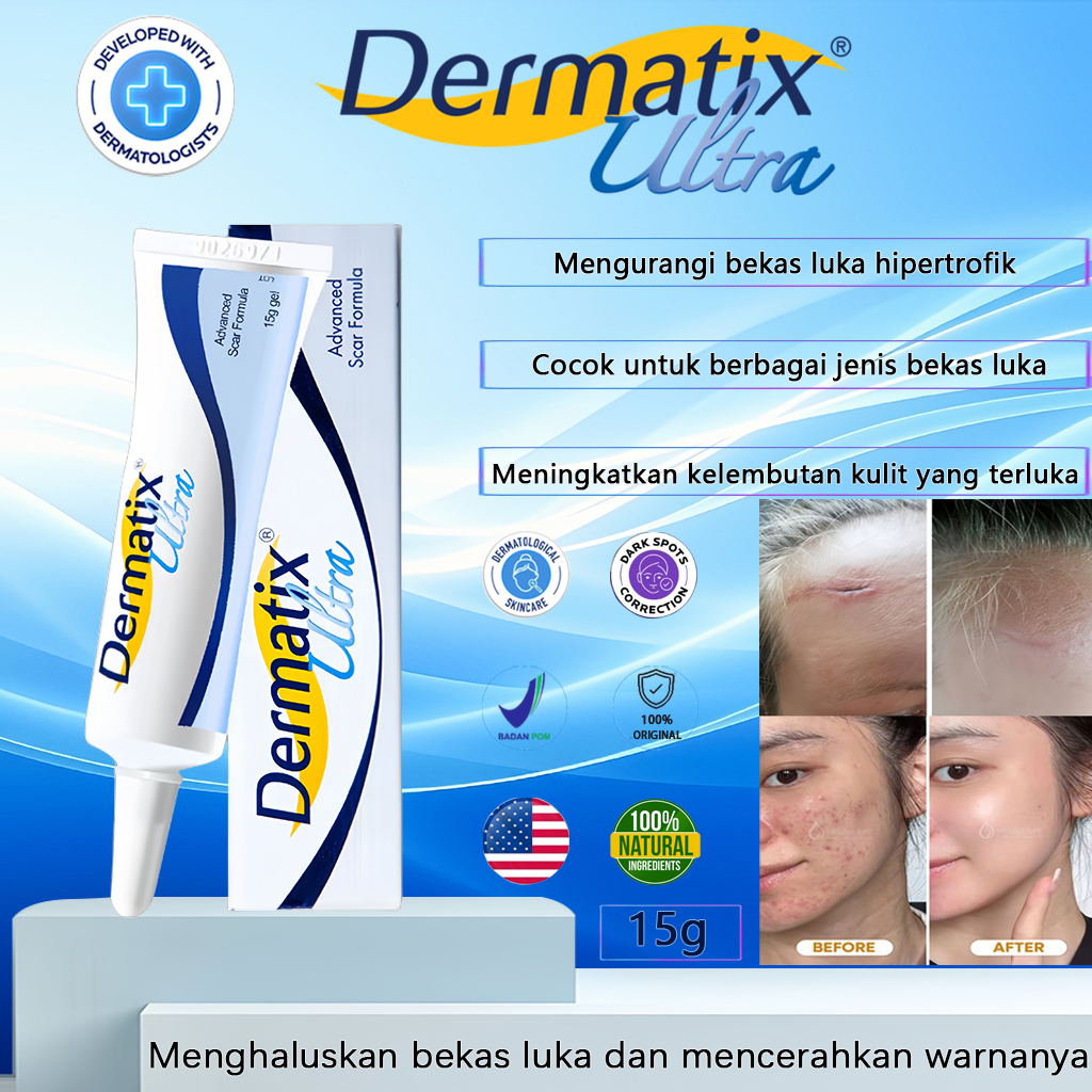 Jual [100% Impor Asli EXP2027][COD]Dermatix Salep Penghilang Bekas Luka ...