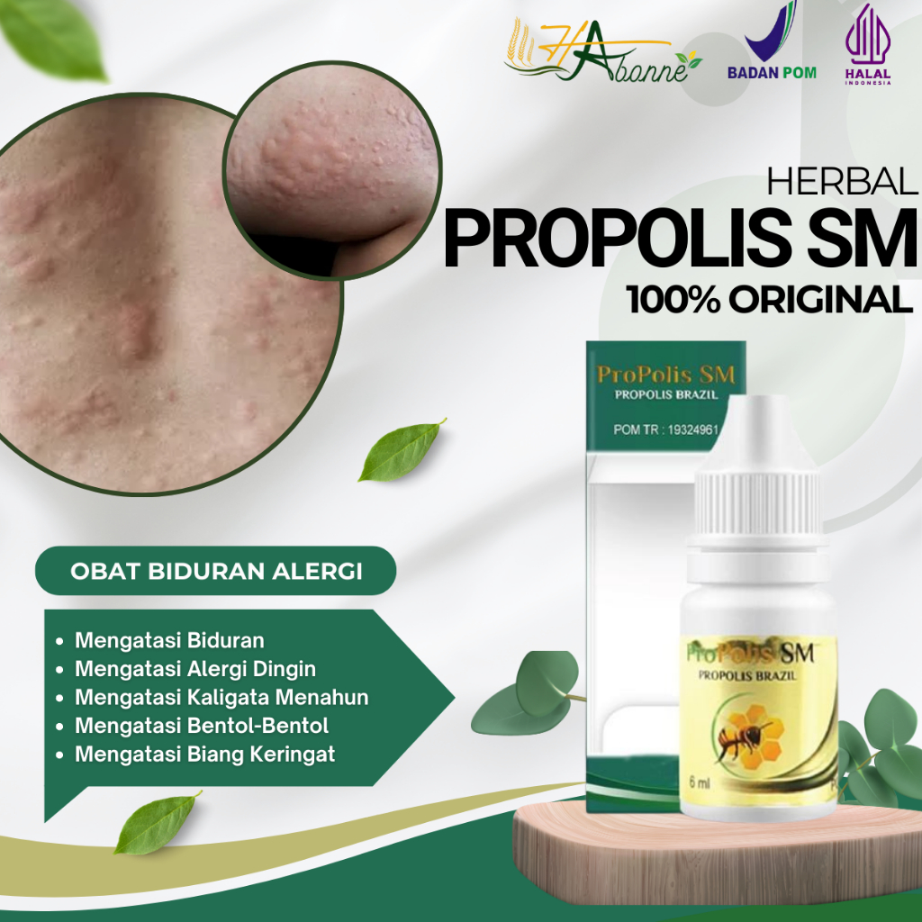 Jual Obat Biduran Alergi Dingin Bentol Kulit Kaligata Biang Keringat ...