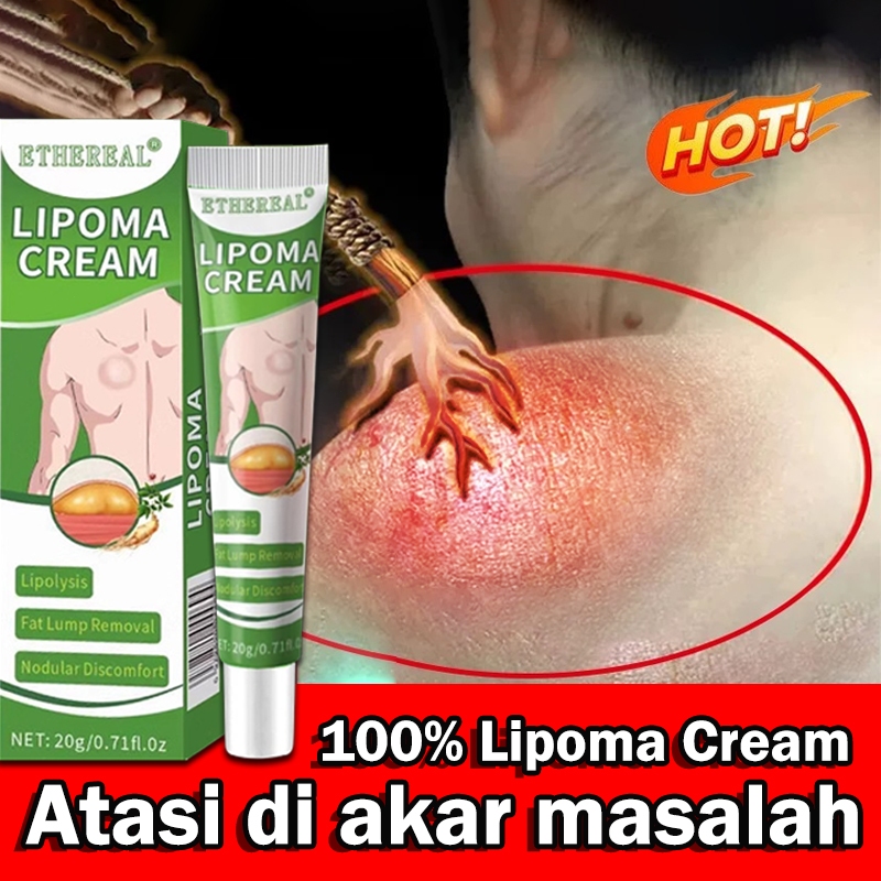 Jual Obat Benjolan Lipoma Cream 20g Obat Herbal Lipoma Obat Lipoma ...