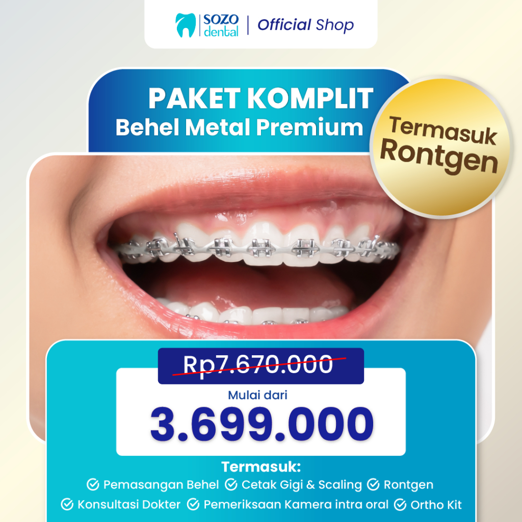 Jual Paket Behel Metal PREMIUM Komplit: Pemasangan Rahang Atas dan ...