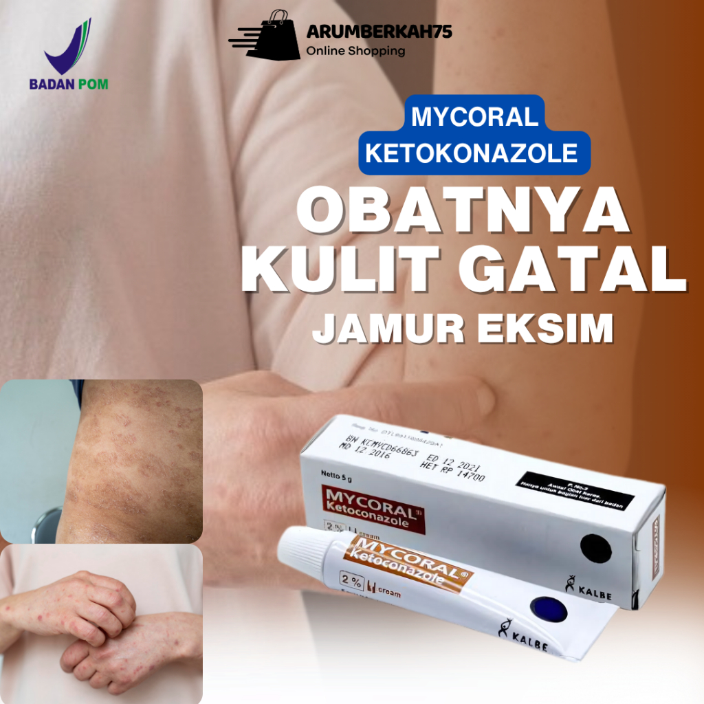 Jual Mycoral Cream 5 gram - Obat Kurap Panu Kadas Salep Gatal Kutu Air ...