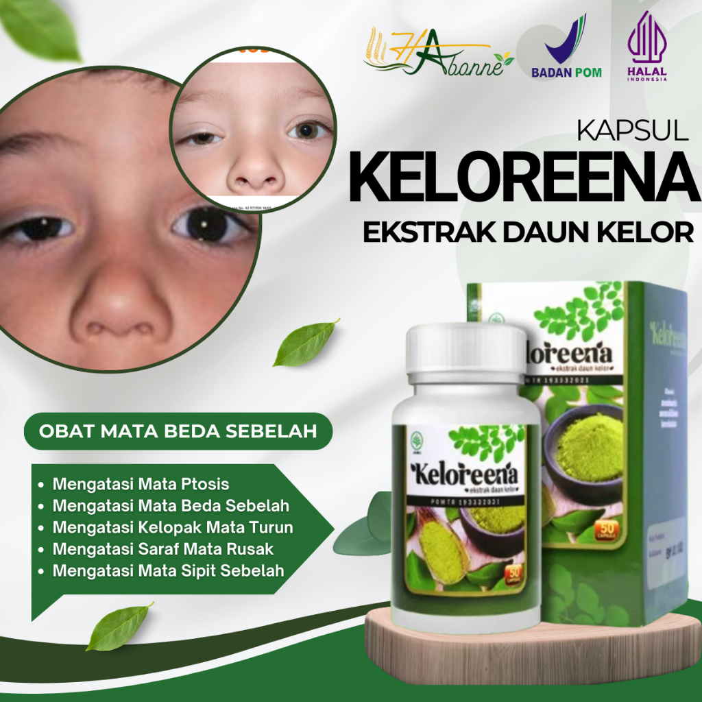 Jual Obat Mata Beda Sebelah, Mata Ptosis, Sipit Sebelah, Kelopak Mata ...