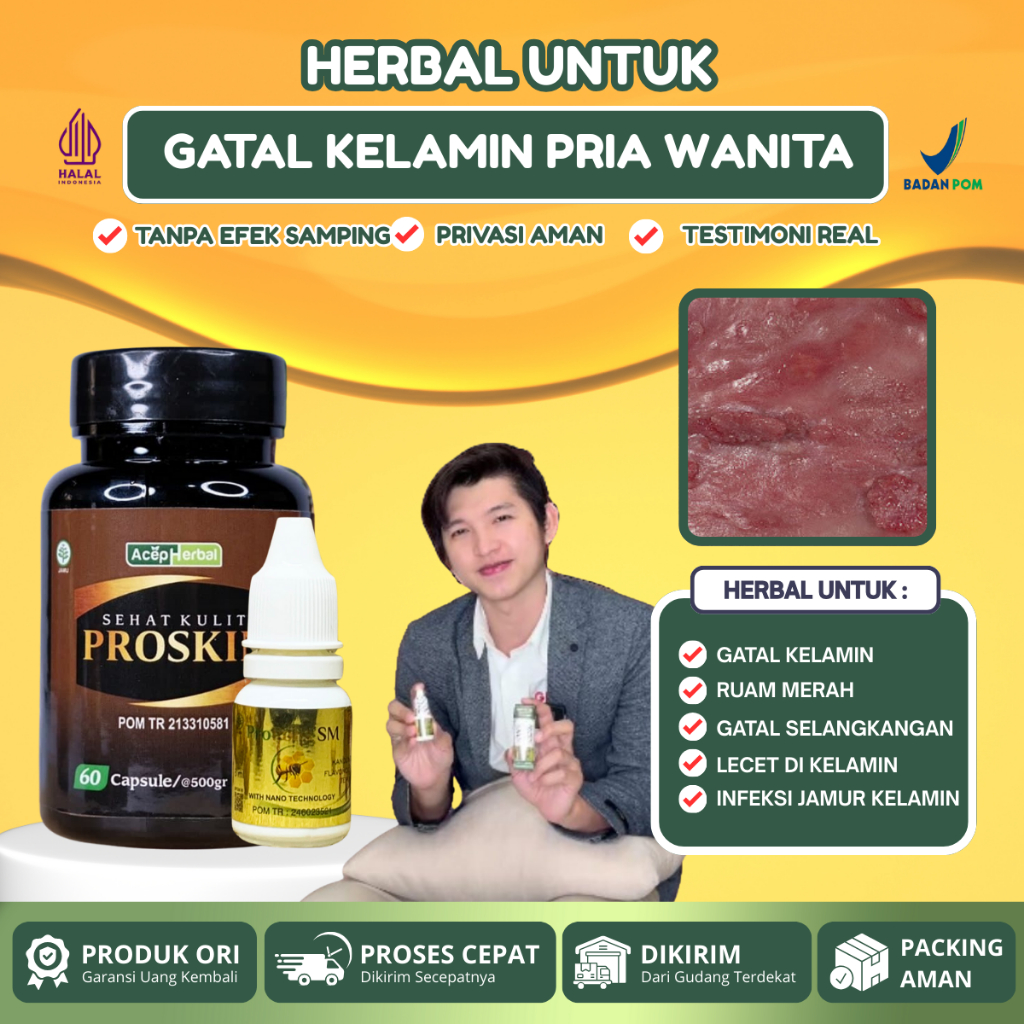 Jual Obat Gatal Kelamin gatal lecet miss v Infeksi jamur kelamin ...
