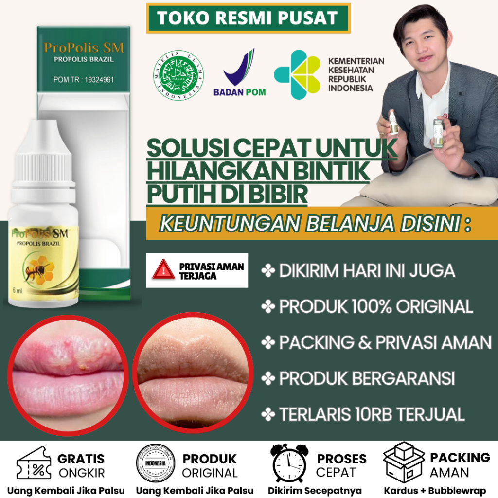 Jual Obat Menghilangkan Bintik Putih di Bibir, Obat Bercak Putih Di ...