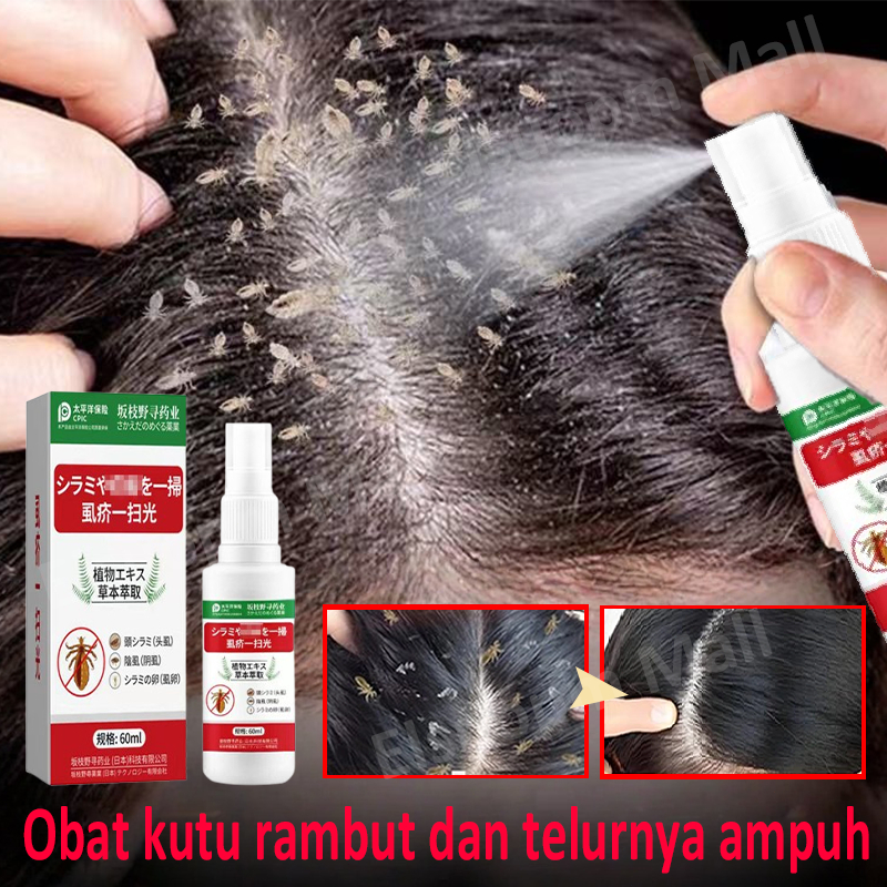 Jual Obat kutu rambut dan telurnya ampuh Peditox kutu rambut anak ...