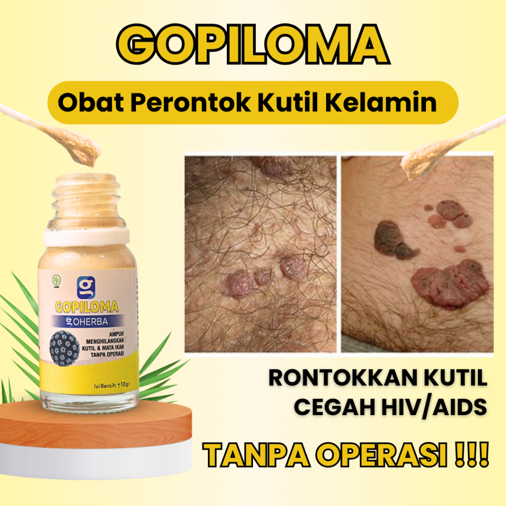 Jual Obat Kutil Kelamin Pria Wanita Gopiloma Paling Ampuh Kutil Rontok ...