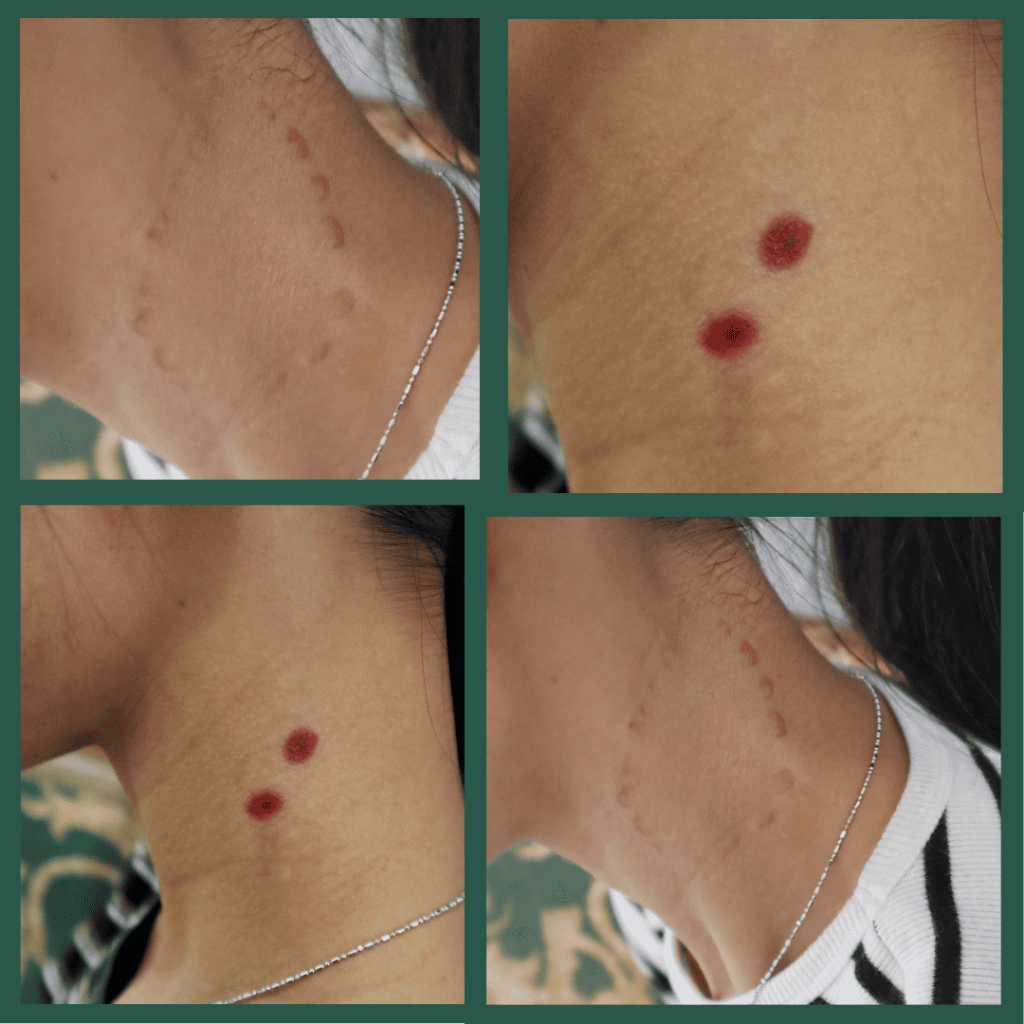 Jual [PRODUK LOKAL] BUNDLING TATO TEMPORER BITE WOUND & VAMPIRE BITE ...
