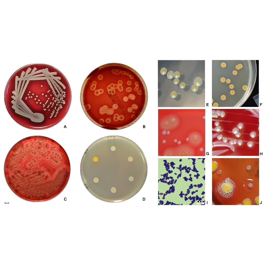 Jual Isolat Staphylococcus aureus subsp. aureus Rosenbach ATCC 25923 ...