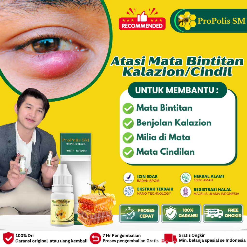 Jual Propolis sm Obat mata bintitan, kalazion, benjolan di mata, obat ...