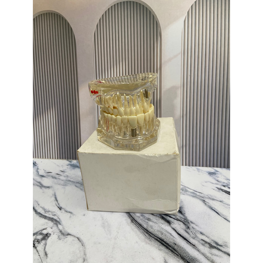 Jual model gigi kasus | dental model kasus | alat peraga gigi kasus ...